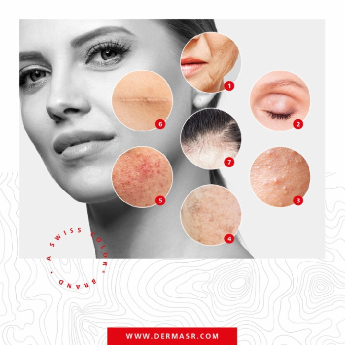 DermaSR - Mikroneulaus :: Kauneushoitola Tunne